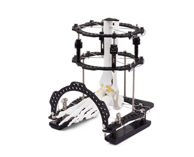 OrthoPediatrics | ORTHEX Small Bone Circular Fixator