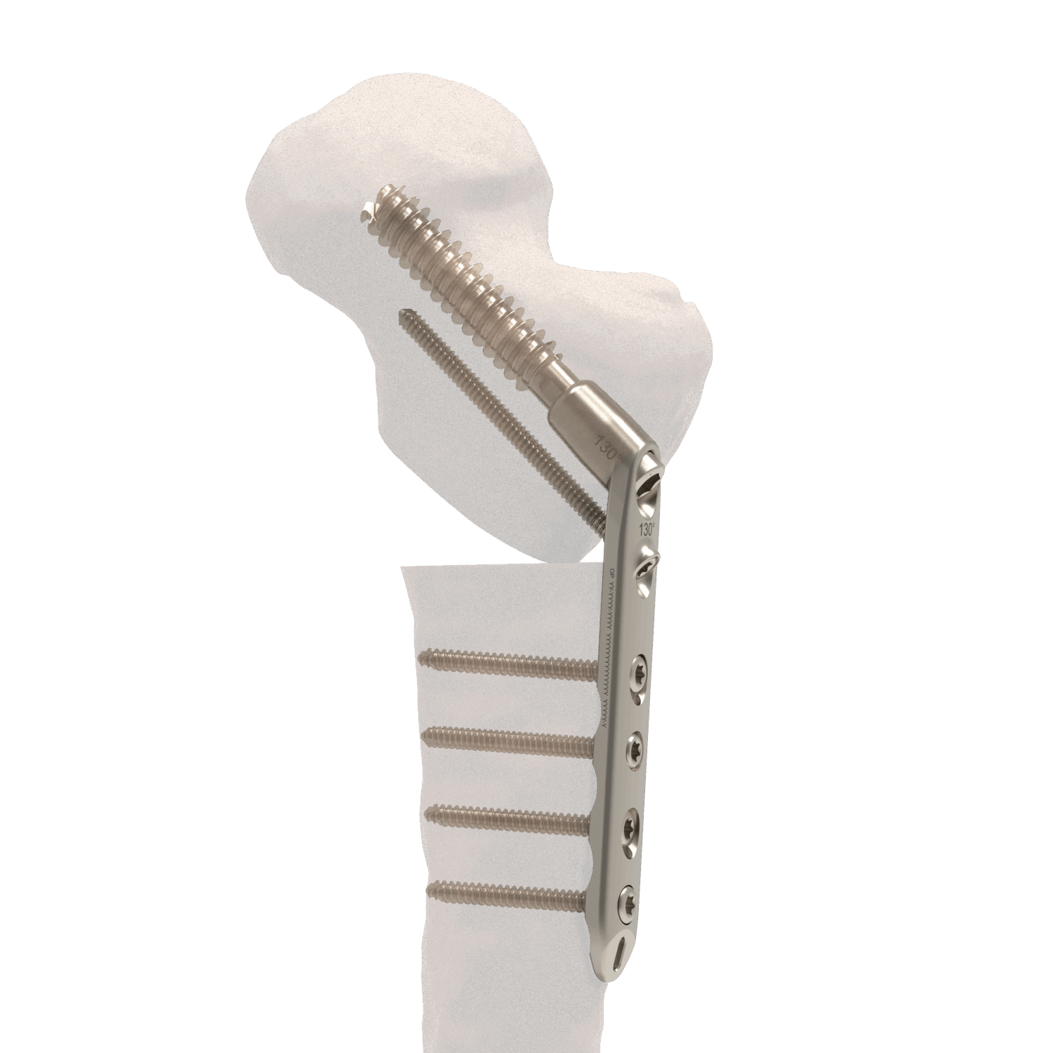 PediLoc® Tibia - OrthoPediatrics