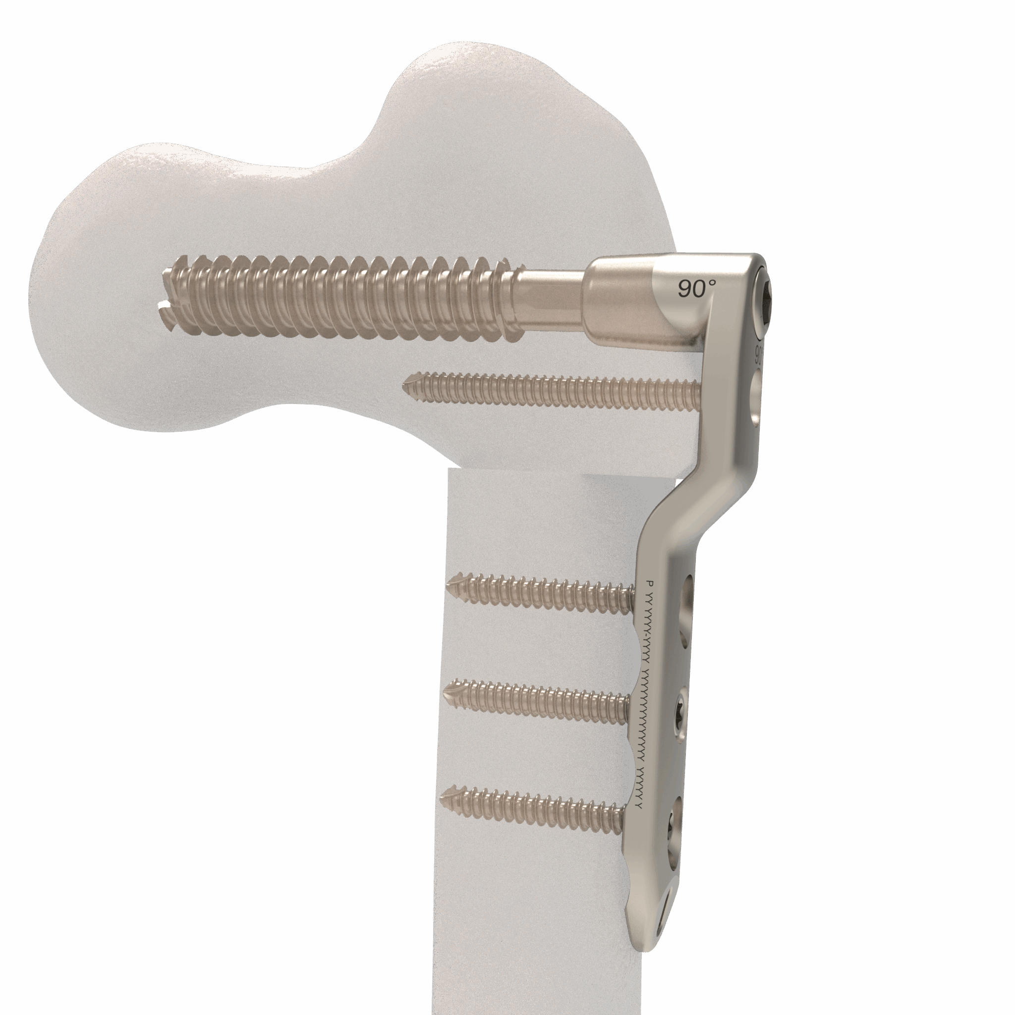 Cerament / Cerament G Bone Void Filler - OrthoPediatrics